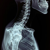 X ray, anatomy and human body or skeleton on film, injury and mri ...