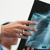 Nurse, hands and x ray analysis in hospital, professional consultation ...