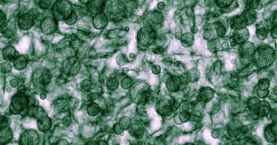 Microscope, virus and zoom of bacteria science technology in medical ...