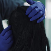 Doctor hands, patient and check scalp for healthcare, dandruff or lice ...
