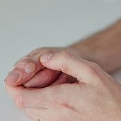 Hands, boil and dermatology with swelling, person and inflammation with ...